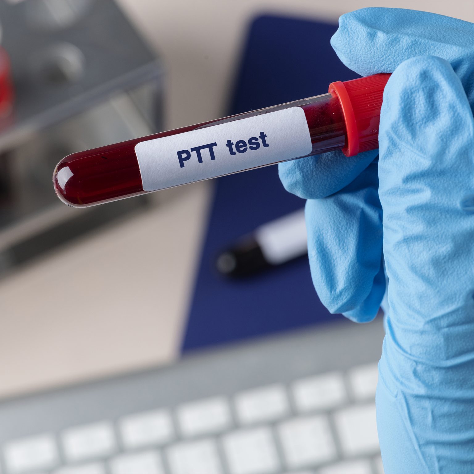 شیکاریی (PTT)(Partial Thromboplastin Time): – NAW LAB