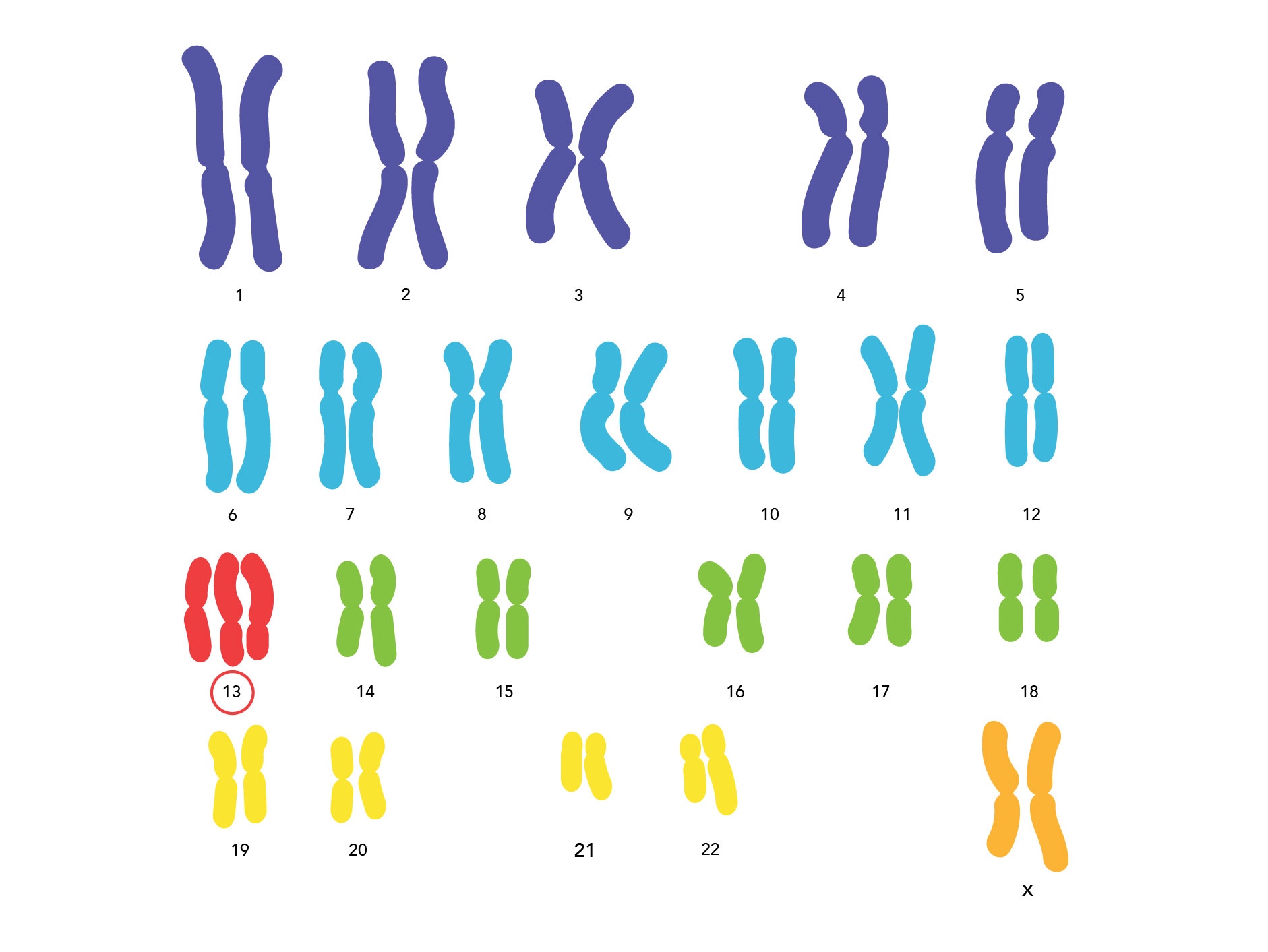 Patau syndrome – NAW LAB
